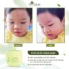 Kem muỗi Oran Baby I'M NATURE - Đại Lý I'm Nature